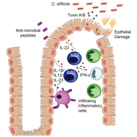 Clostridium Difficile Toxin Clostridium Difficile Toxin