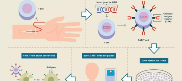 acute lymphoblastic leukemia (ALL) – Creative Biolabs CAR-T Blog