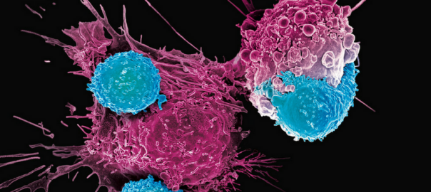 chimeric antigen receptor T cell therapy – Creative Biolabs CAR-T Blog