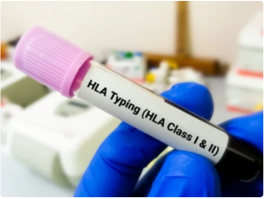 HLA System and HLA Typing – Creative Biolabs CAR-T Blog