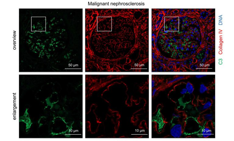 Br J Pharmacol: Complement C3 as a New Target for Reducing Proteinuria ...