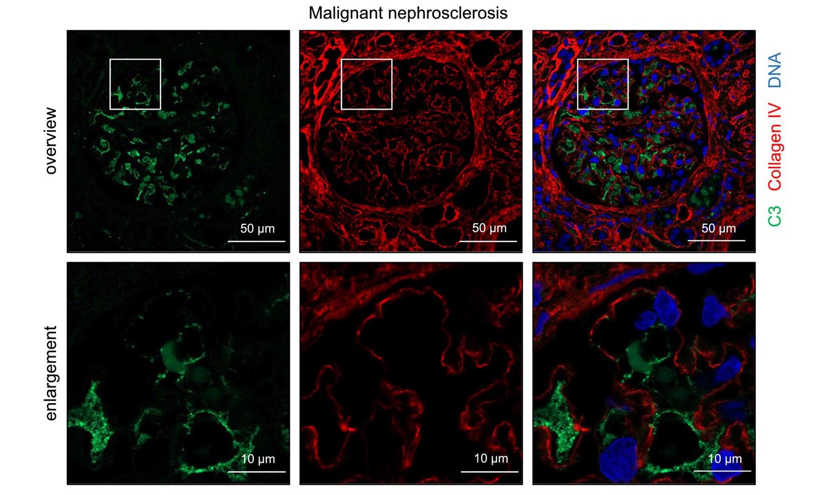 Br J Pharmacol: Complement C3 as a New Target for Reducing Proteinuria ...