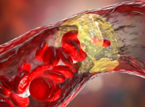 Creative Biolabs Complement Therapeutics Blog