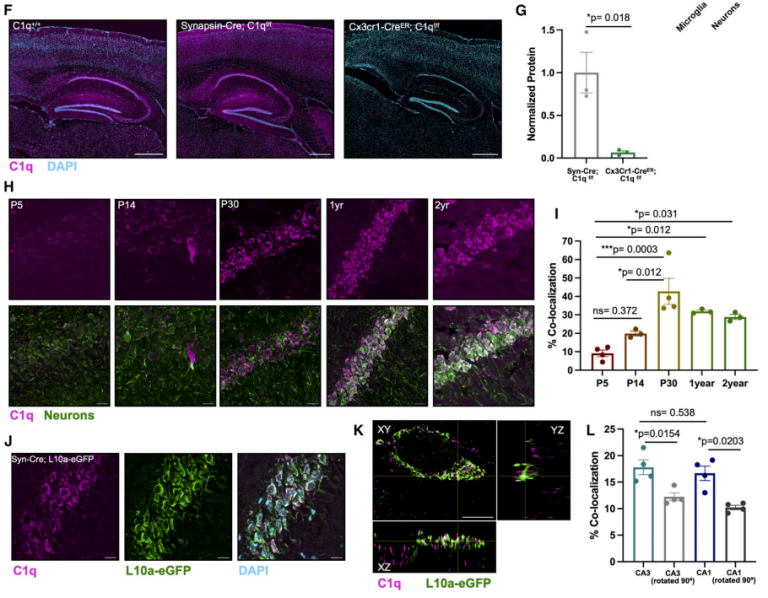 Aging Promotes a Functional Shift in C1q Secreted by Microglia ...