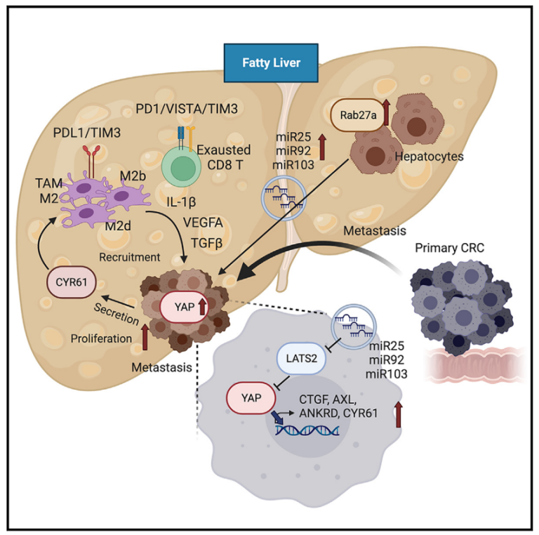 Extracellular Vesicles in Fatty Liver Promote a Metastatic Tumor ...