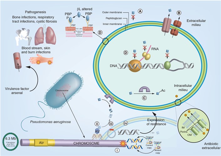 Pseudomonas Aeruginosa Burn Infection