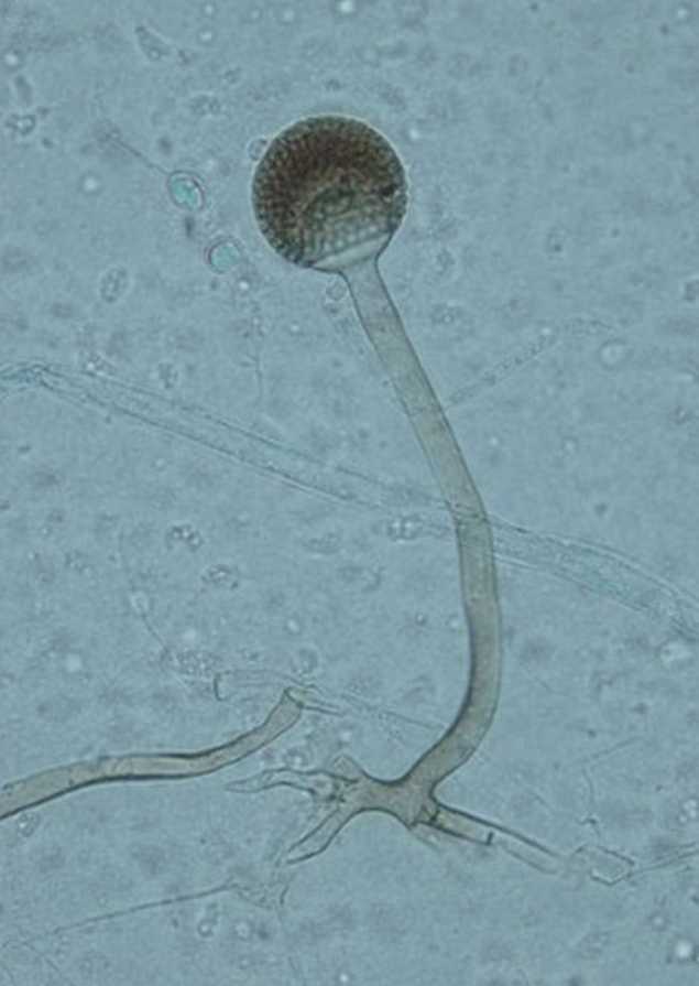 Rhizopus Under Compound Microscope