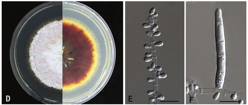 Tinea Mentagrophytes