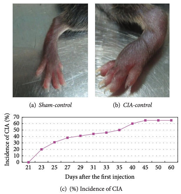 Rheumatoid Collagen Disease