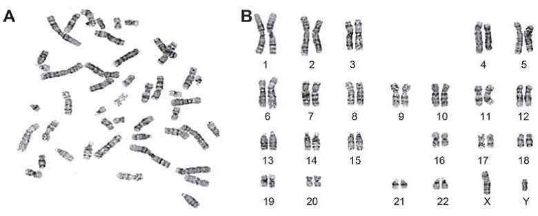 Basic question about chromosomes. : r/genetics